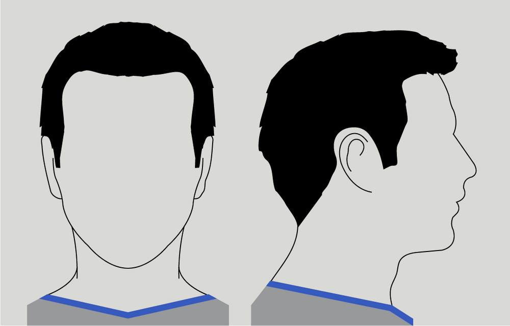 Hair Loss Treatments for Men | XYON Treatments & Products