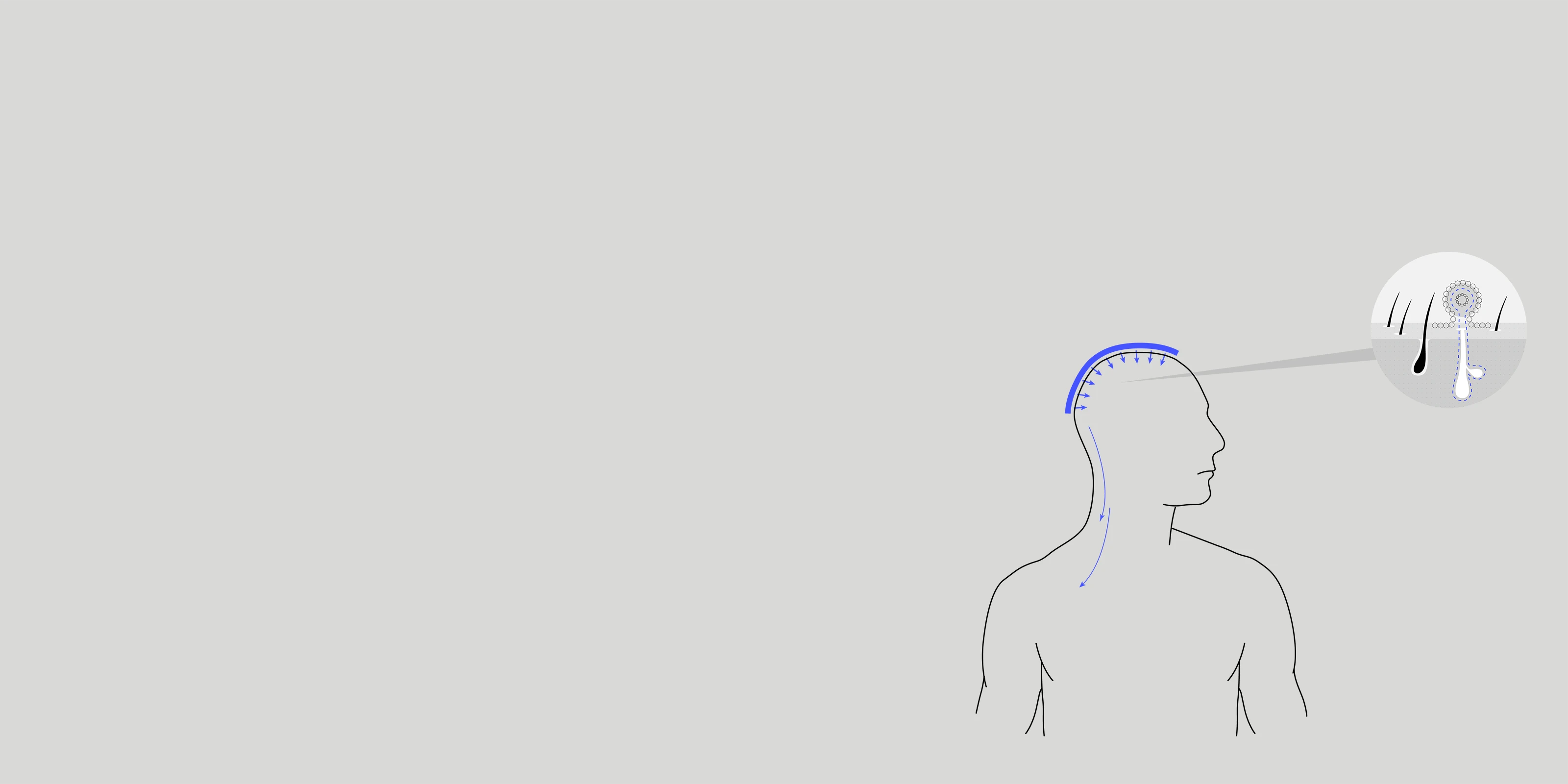 XYON SiloxysSystem™ Gel | Innovative Topical Drug Delivery