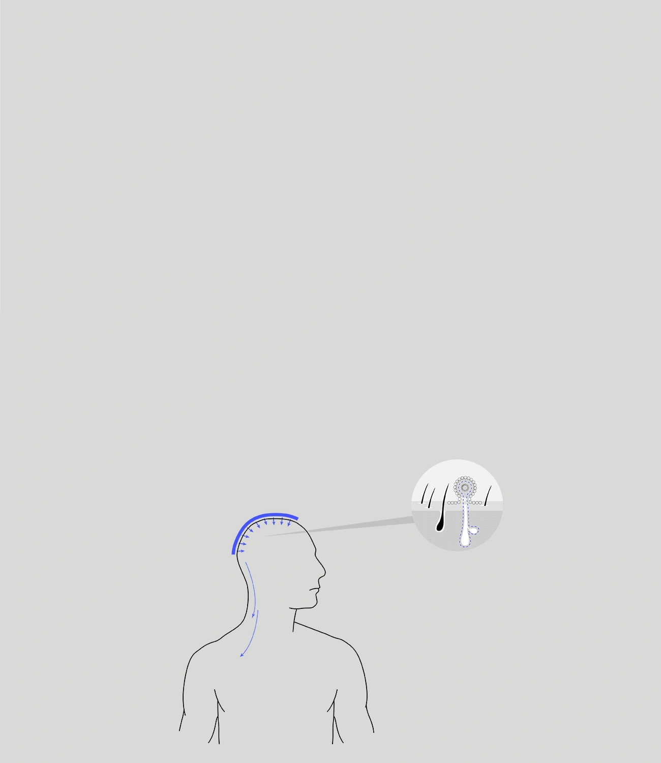 XYON SiloxysSystem™ Gel | Innovative Topical Drug Delivery